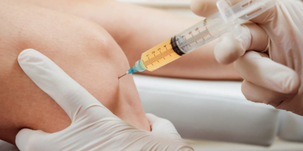 Hyaluronic Acid (ha) Knee Injections for Osteoarthritis Pain ...